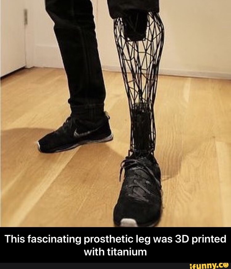 This fascinating prosthetic leg was 3D printed with titanium - This ...