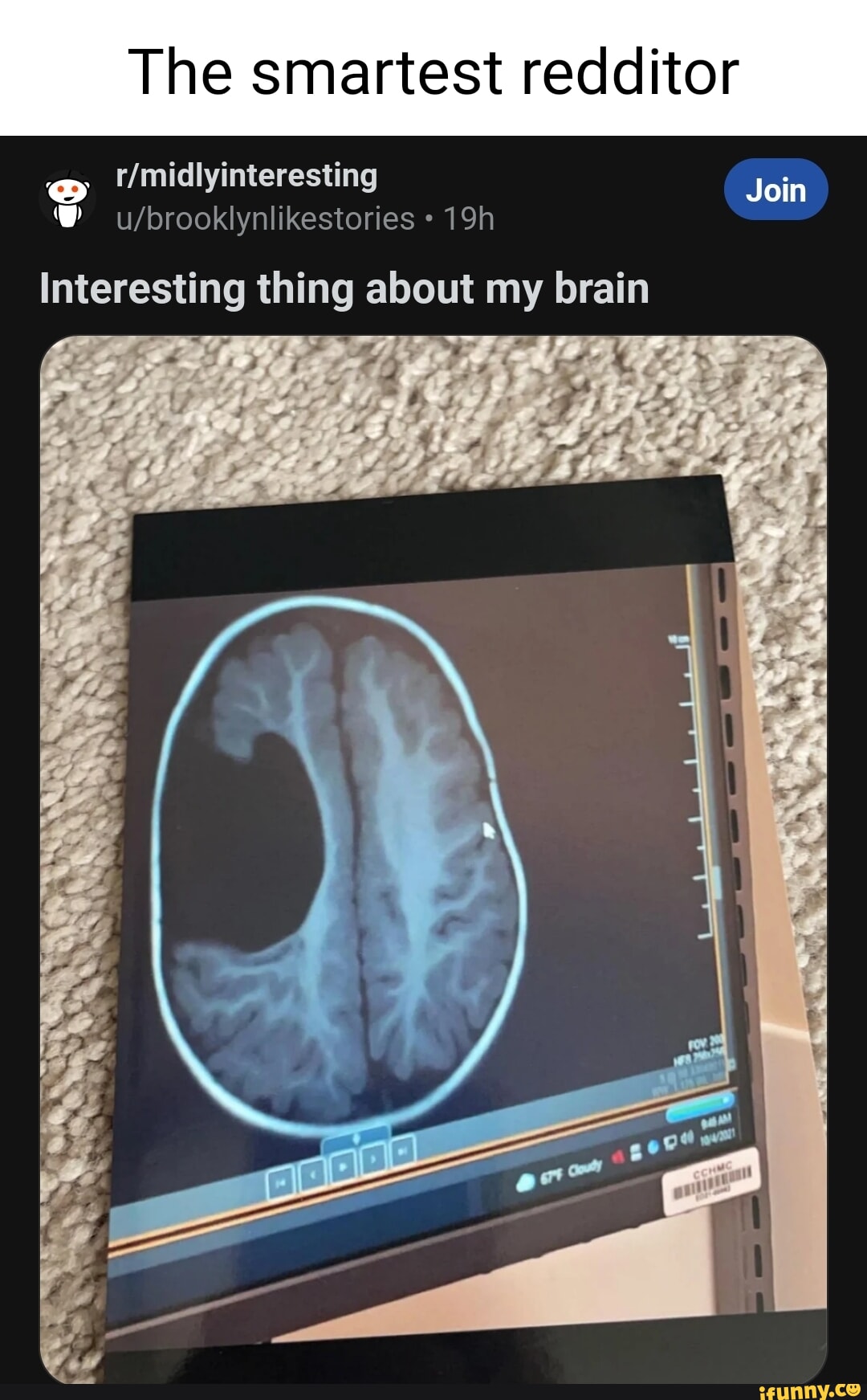 The smartest redditor Join Interesting thing about my brain Fig' - iFunny