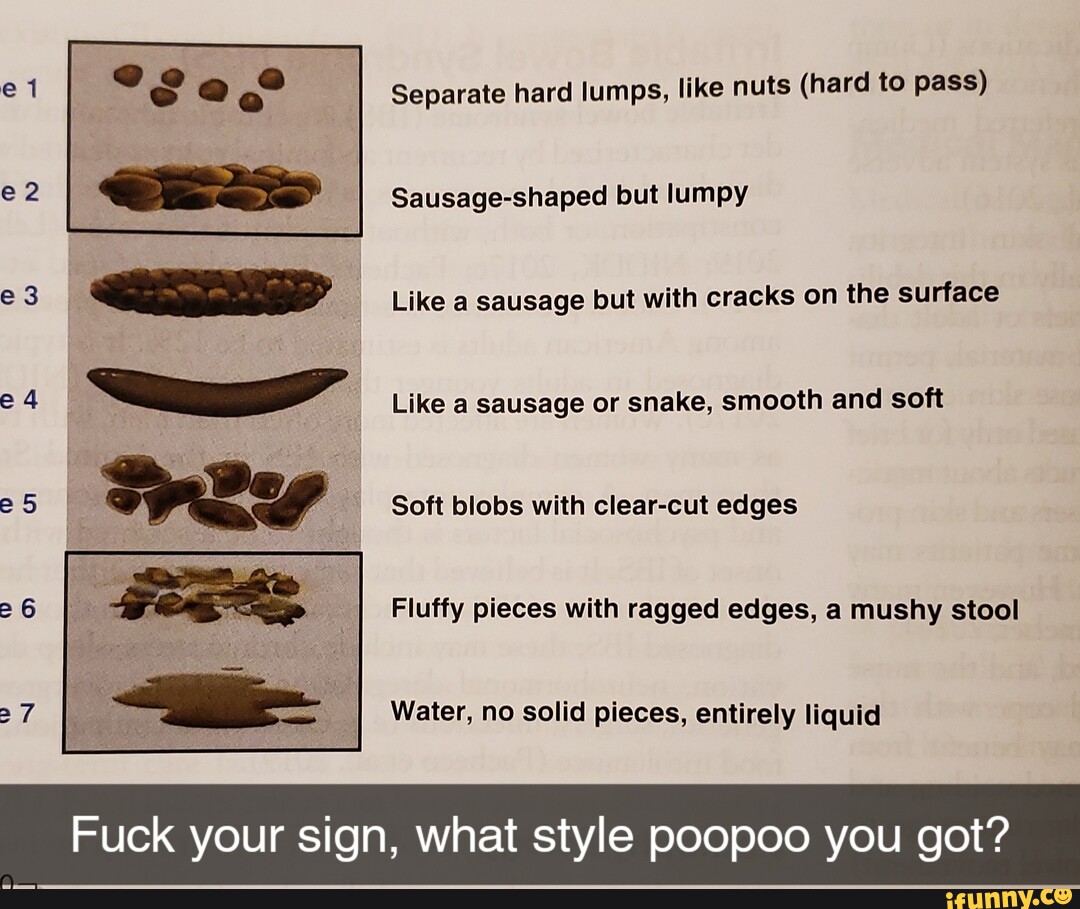Separate hard lumps, like nuts (hard to pass) Sausage-shaped but lumpy ...