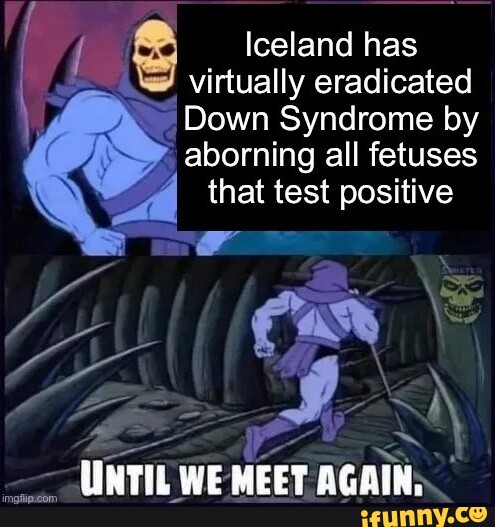 Iceland has virtually eradicated Down Syndrome by aborning all fetuses ...
