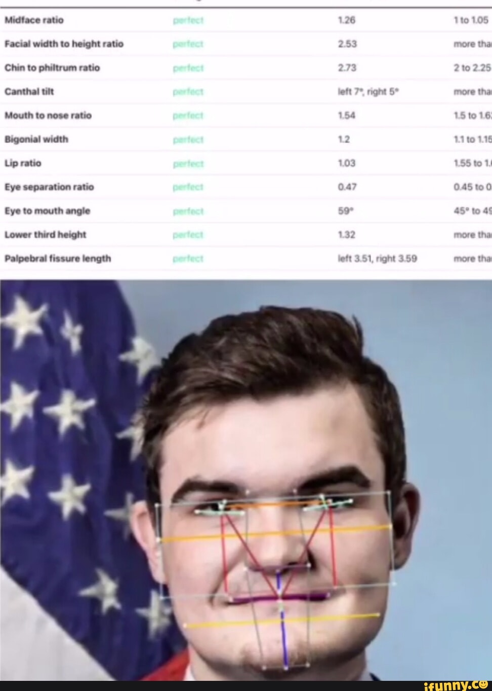 Midtace ratio Facial width to height ratio Chin to philtrum ratio ...