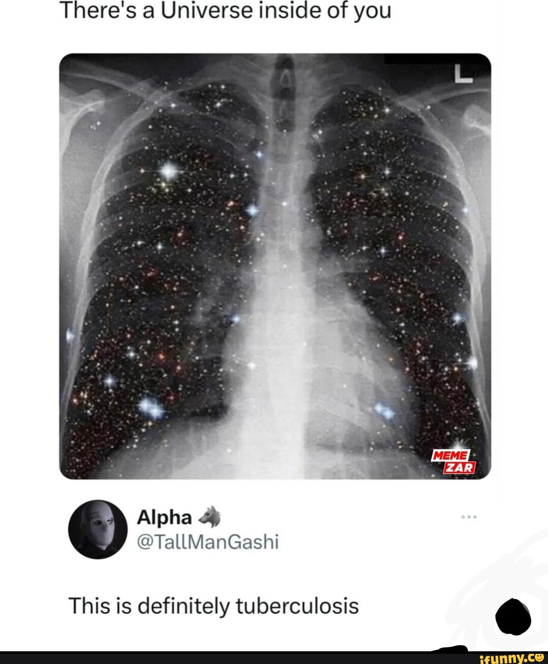 Tuberculosis memes. Best Collection of funny Tuberculosis pictures on ...