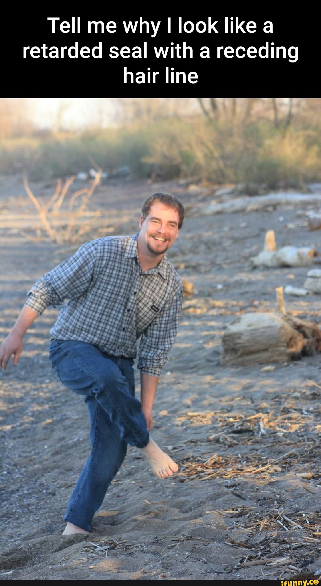 Receding memes. Best Collection of funny Receding pictures on iFunny