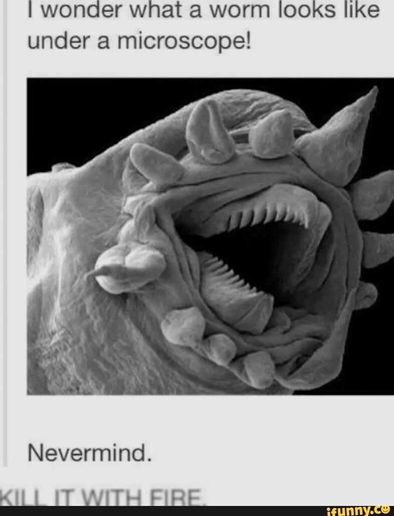 Wonder wnat a worm looks like under a microscope! Nevermind. iT WITH ...
