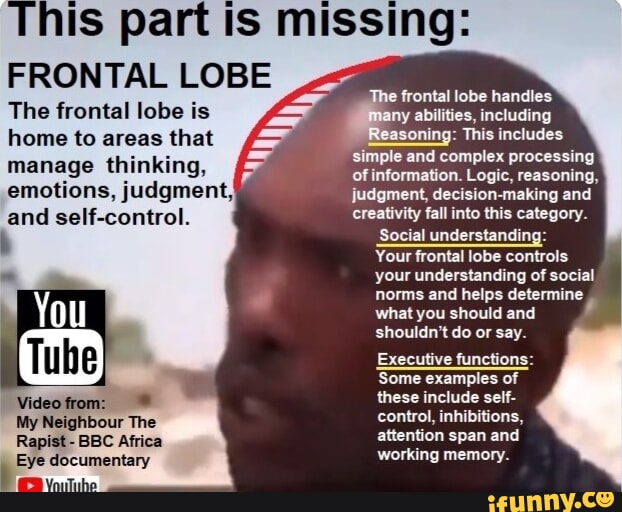 This part is missing: FRONTAL LOBE The frontal lobe handles The frontal ...