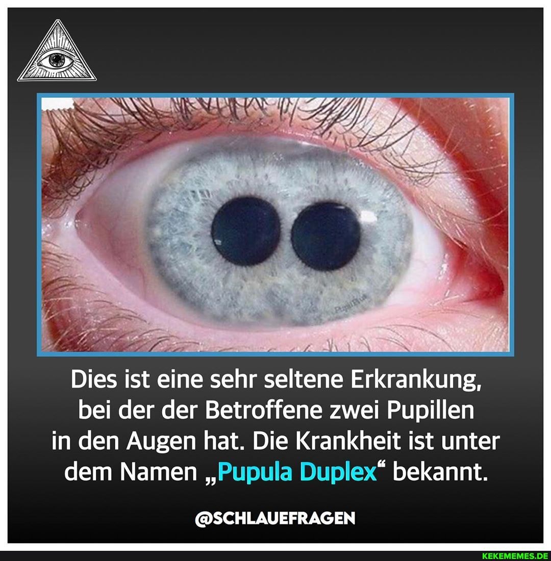 Krankheitsbild Kleine Pupillen
