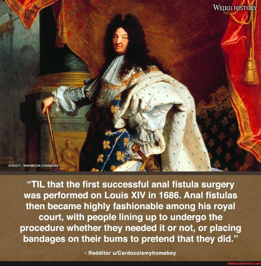 12 Strange Facts About French Royalty We Just Learned That Made Us Say ...