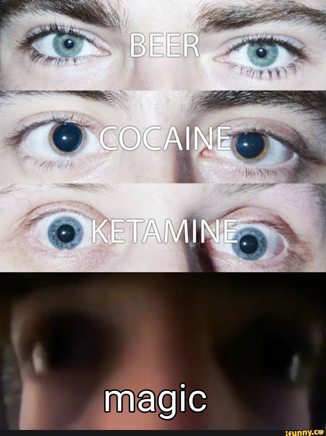Ketamine Eyes