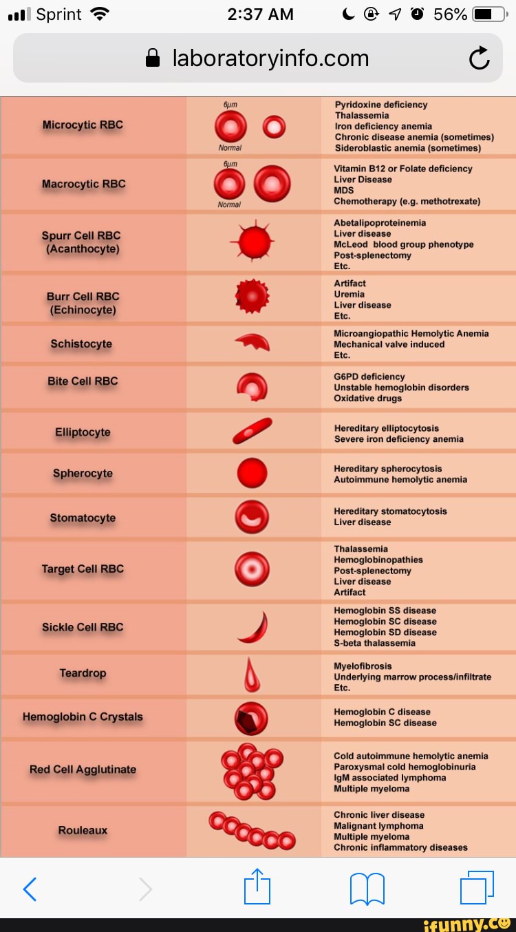 Sharing my click hole. -warning- blood. - Sprint Microcytic RBC ...