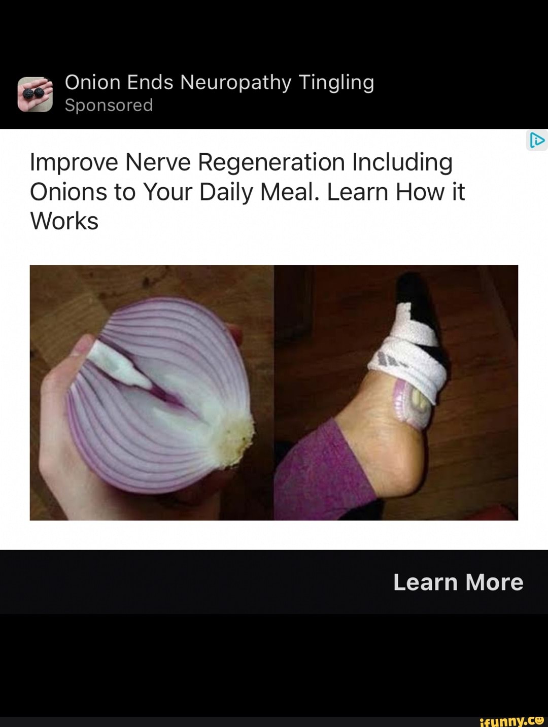 Neuropathy memes. Best Collection of funny Neuropathy pictures on iFunny