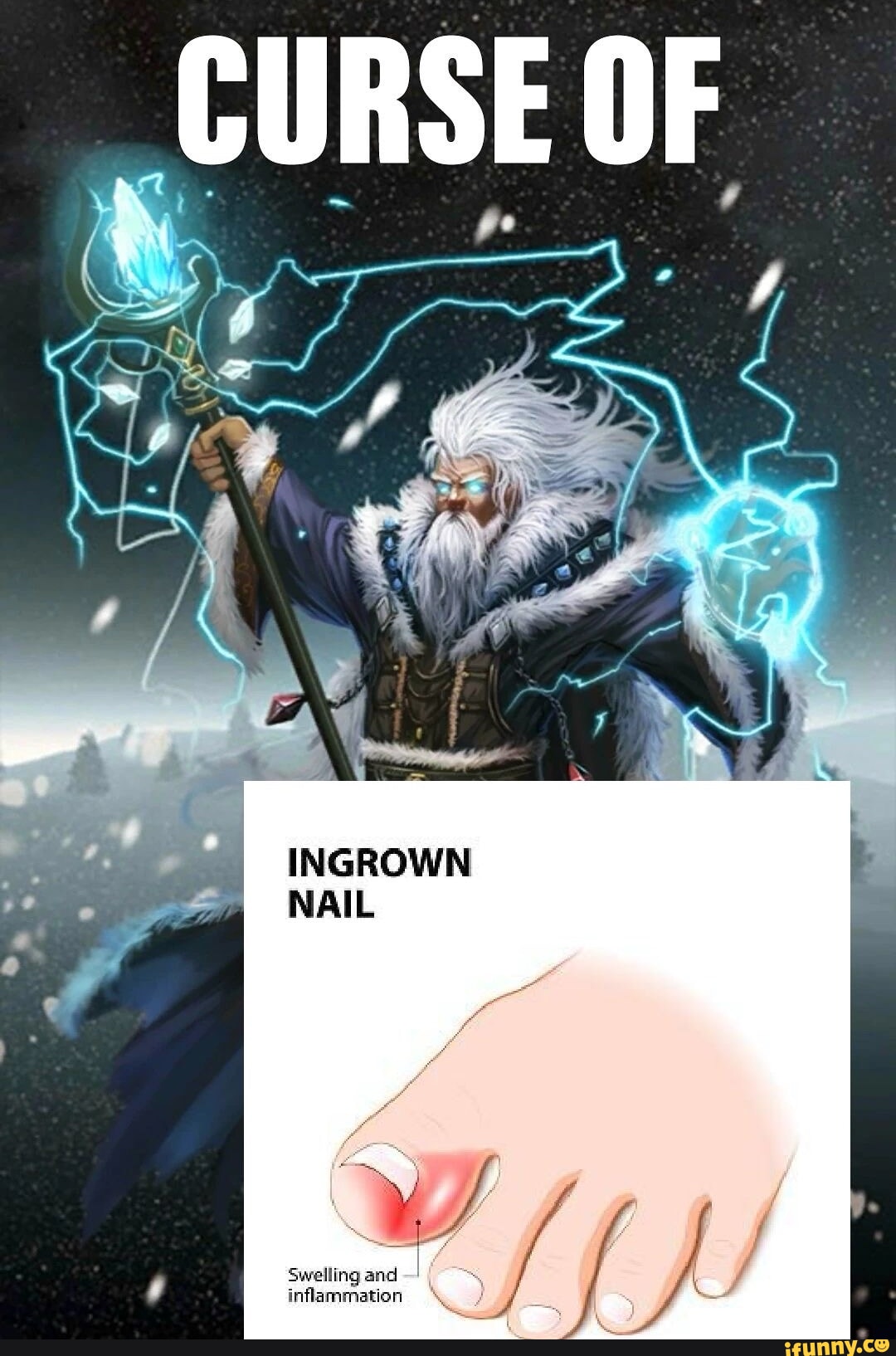 CURSE OF INGROWN NAIL Swelling and inflammation - iFunny