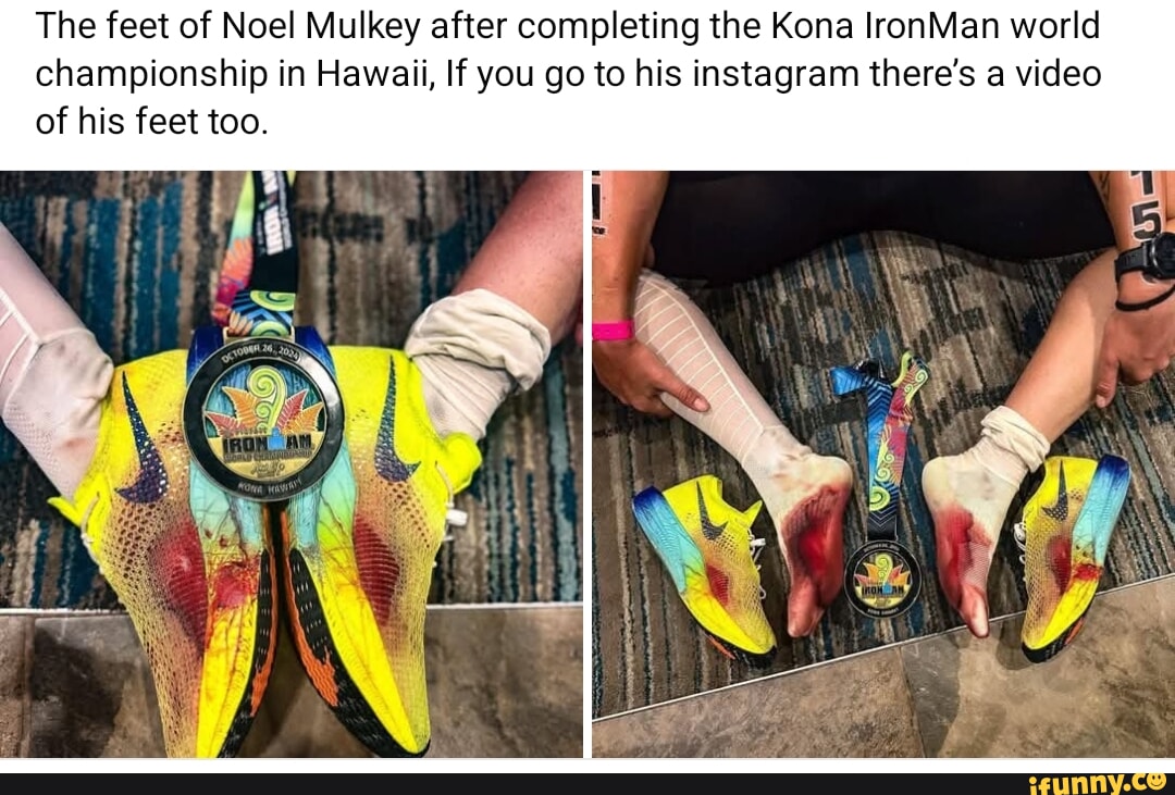 The feet of Noel Mulkey after completing the Kona IronMan world ...
