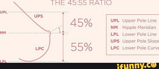 UPL NM ups 45% 55% TRE RATIO UPL Upper Pole Line NM Nipple Meridian LPL ...