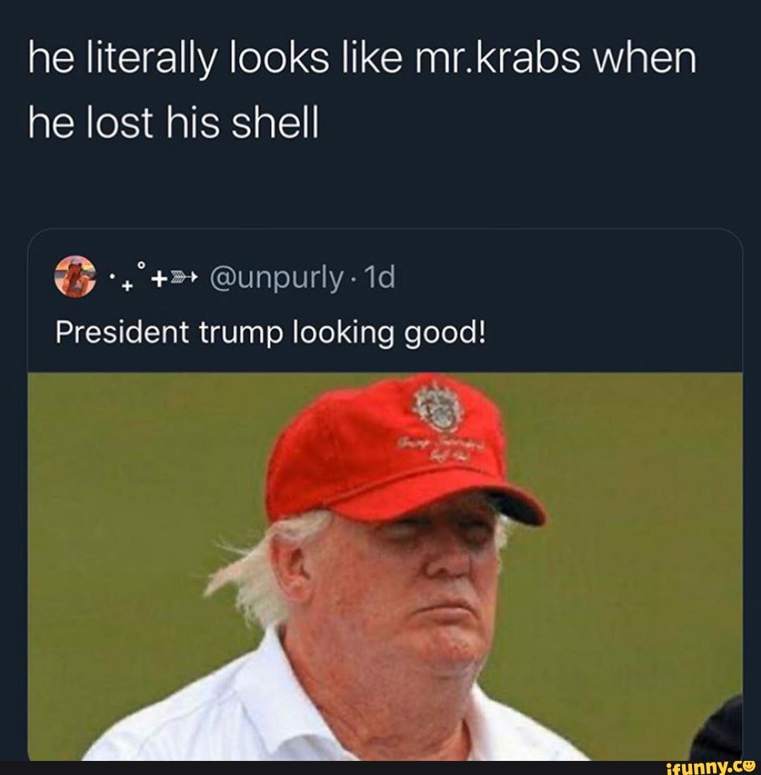 He literally looks like mr.krabs when he lost his shell ª -+°+D+ ...