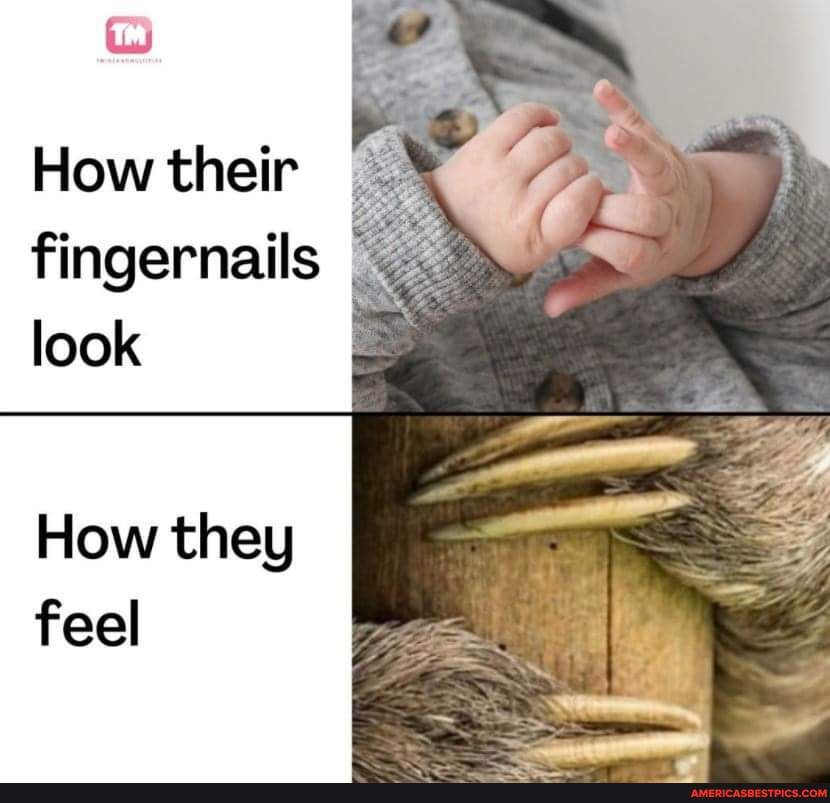 How their fingernails look How they feel - America’s best pics and videos