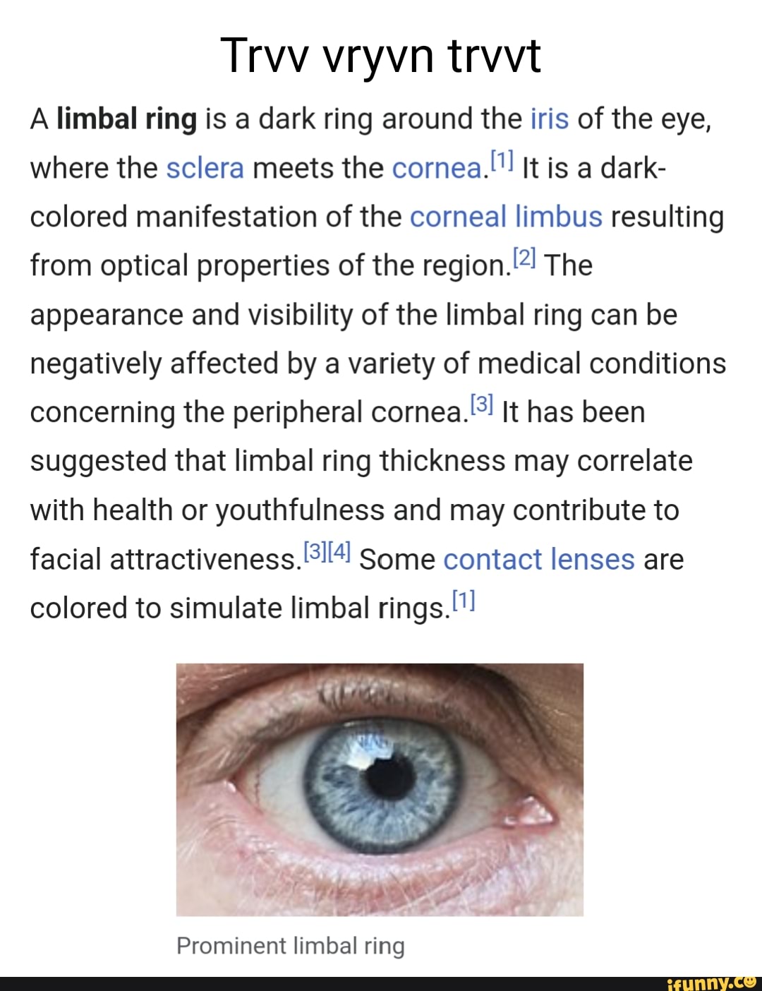 Cornea memes. Best Collection of funny Cornea pictures on iFunny