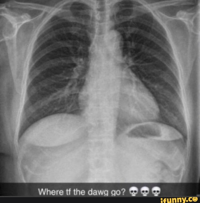 Where Tf The Dawg Go IFunny where-tf-the-dawg-go-ifunny