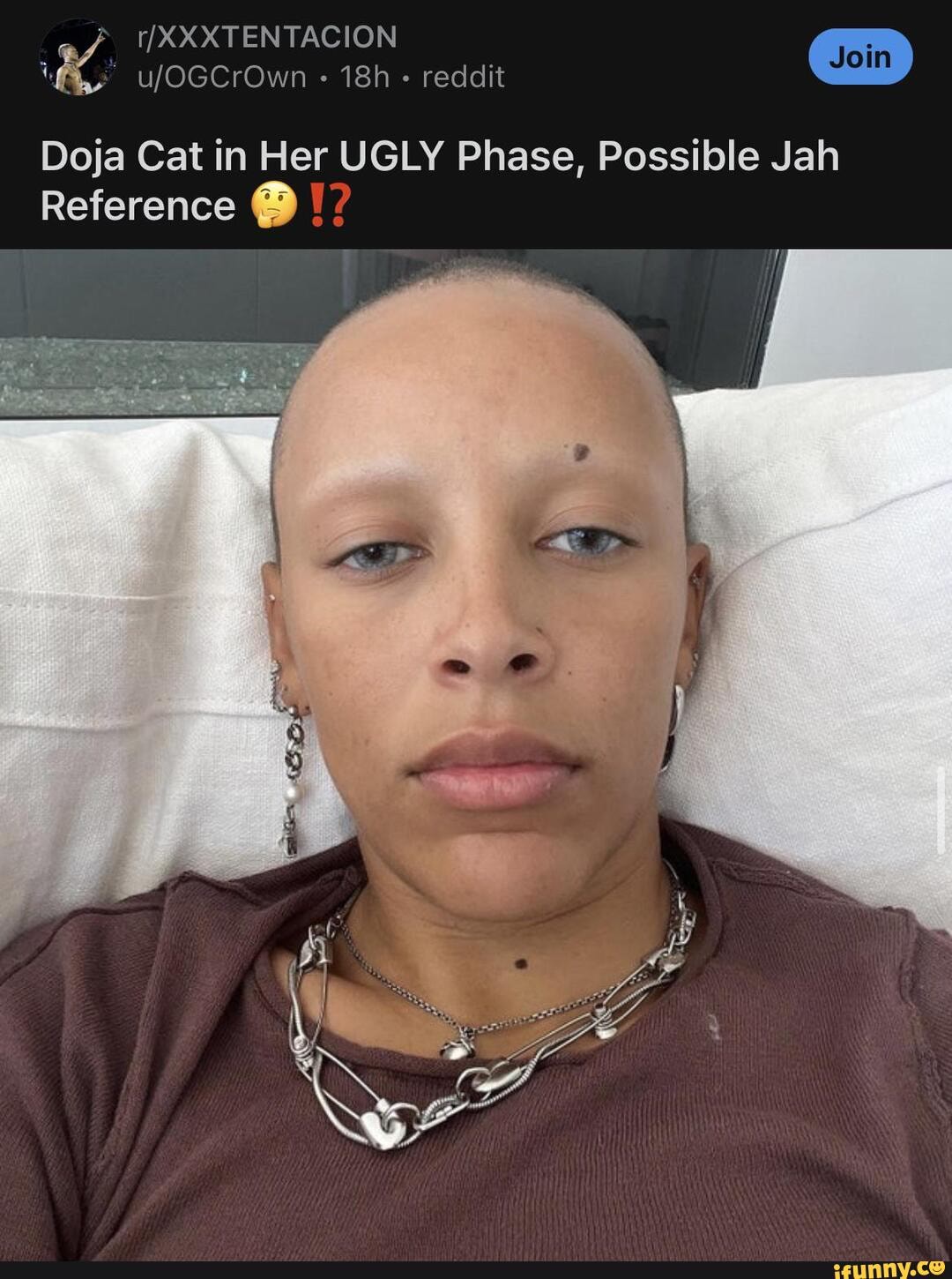 Af tiXXXTENTACION ufOGCrOwn reddit Doja Cat in Her UGLY Phase, Possible ...