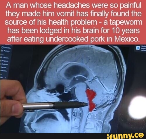 Tapeworm memes. Best Collection of funny Tapeworm pictures on iFunny