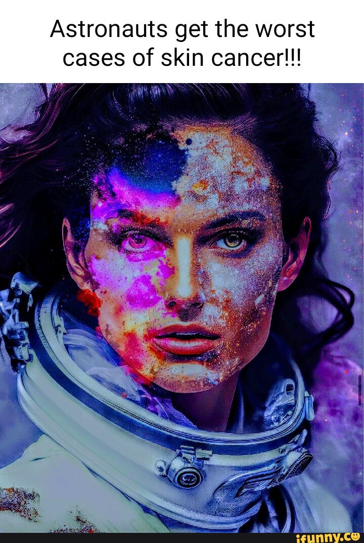 Astronauts get the worst cases of skin cancer!!! - iFunny