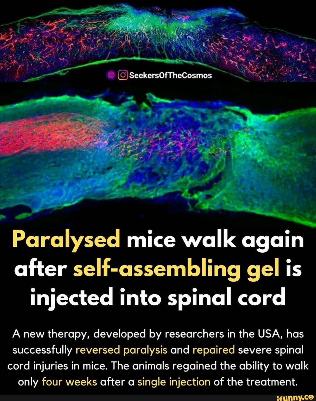 Paralysed mice walk again after self-assembling gel is injected into ...