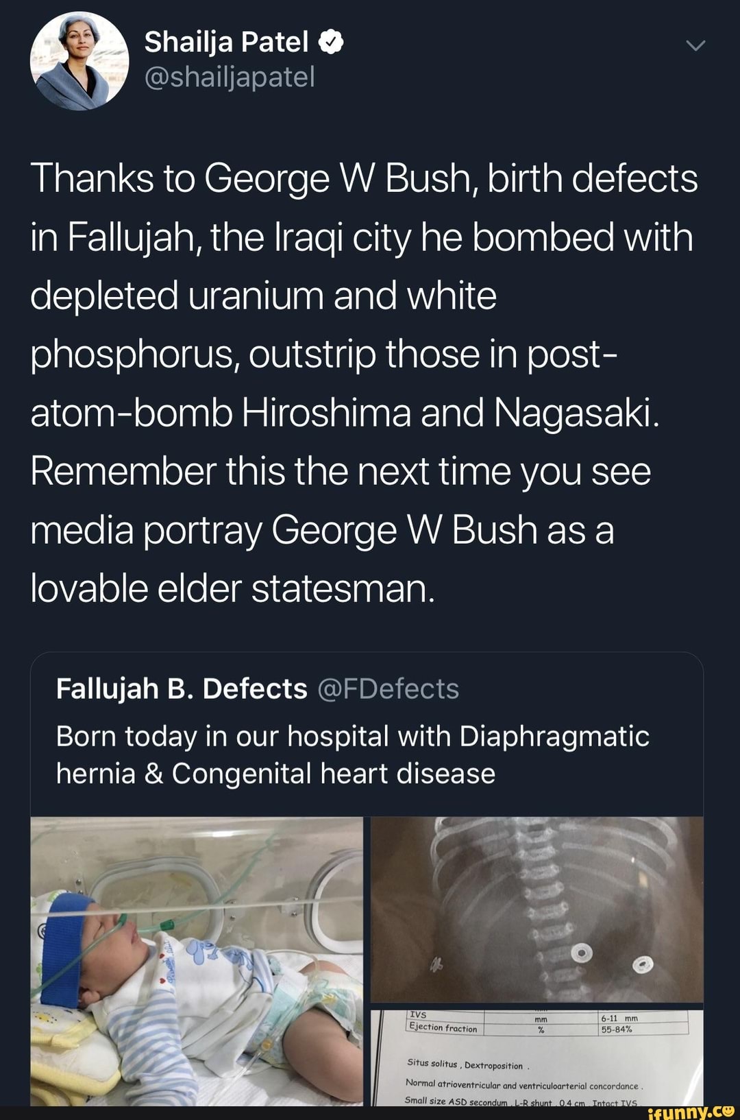 Thanks to George W Bush, birth defects in Fallujah, the Iraqi City he ...