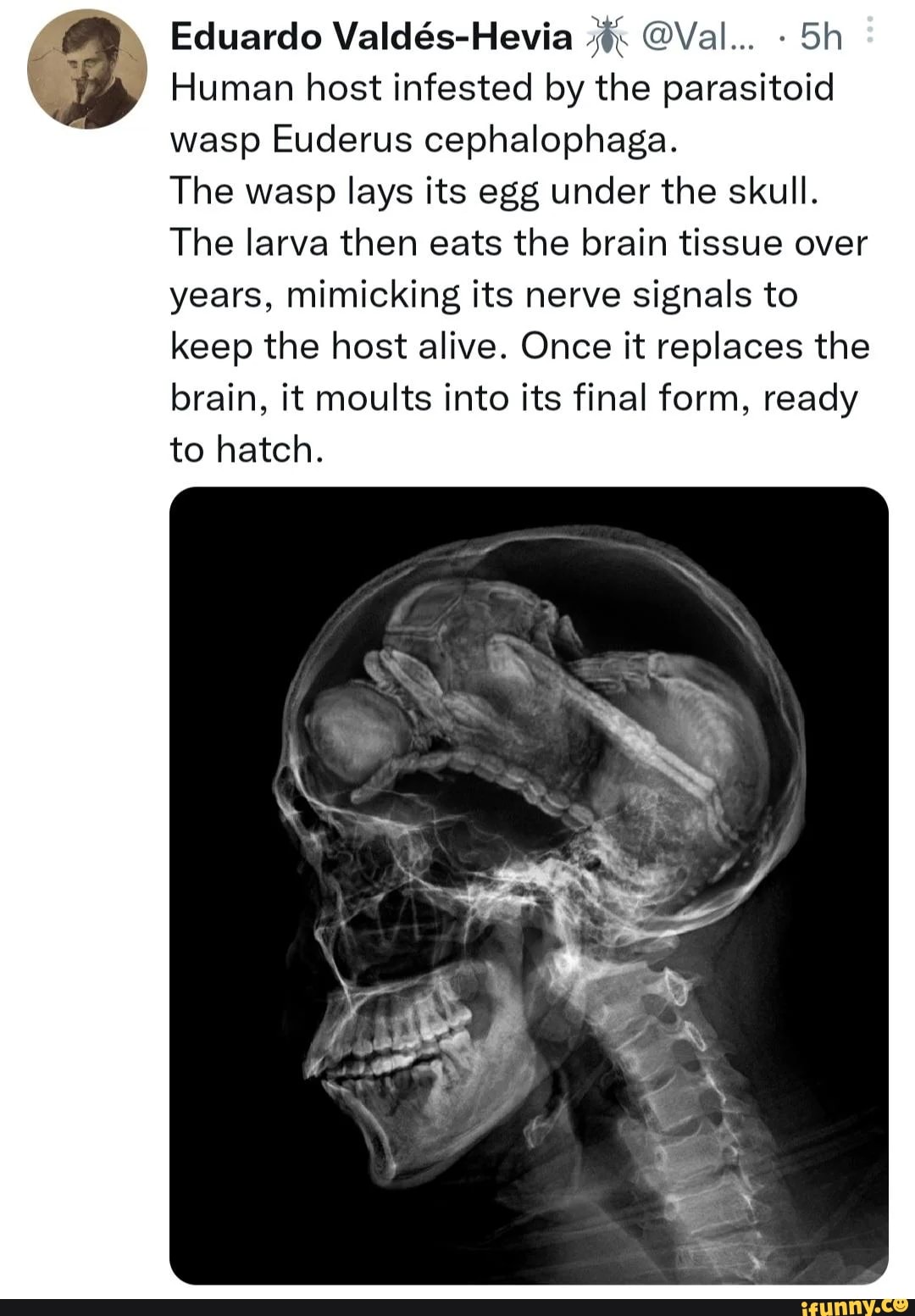 Eduardo Valds-Hevia @Val... Sh Human host infested by the parasitoid ...