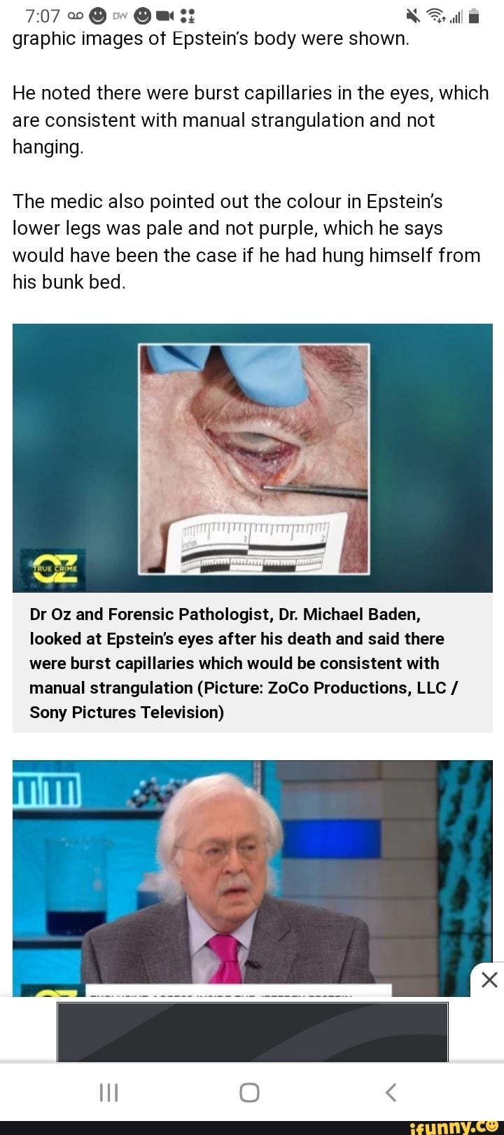 Oms: graphic images of Epstein's body were shown. He noted there were ...