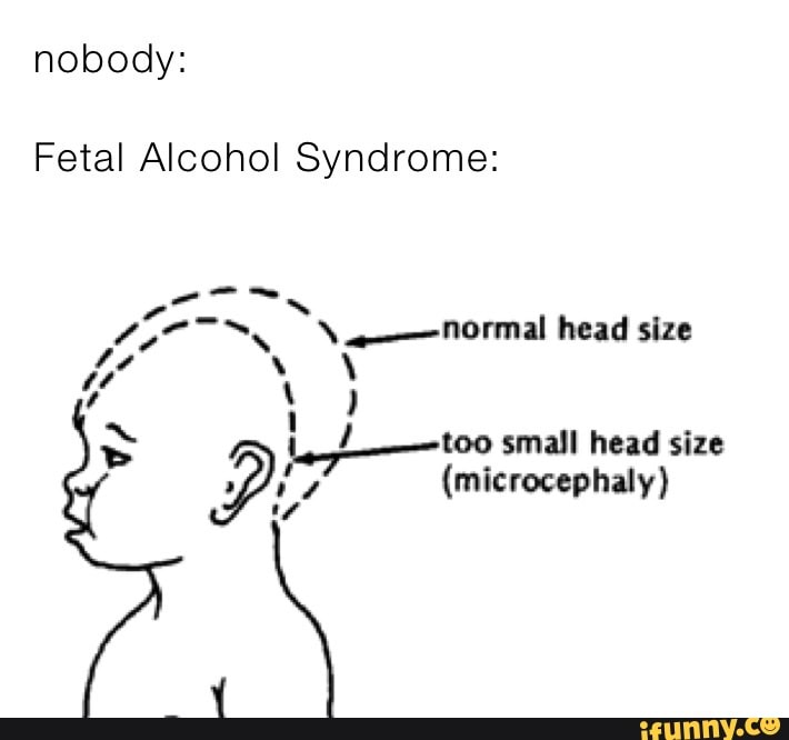 Nobody: Fetal Alcohol Syndrome: too small head size (microcephaly) - iFunny