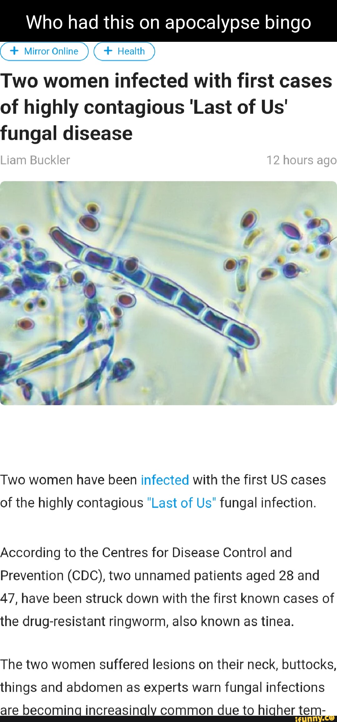 Fungal memes. Best Collection of funny Fungal pictures on iFunny