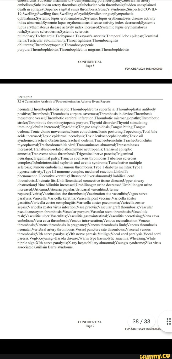Artery vein unexplained death in sagittal sinus COVID- of lupus lupus ...