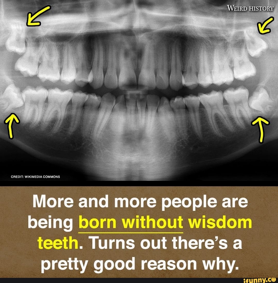 𝗕𝗼𝗱𝗶𝗲𝘀 memes. Best Collection of funny 𝗕𝗼𝗱𝗶𝗲𝘀 pictures on iFunny