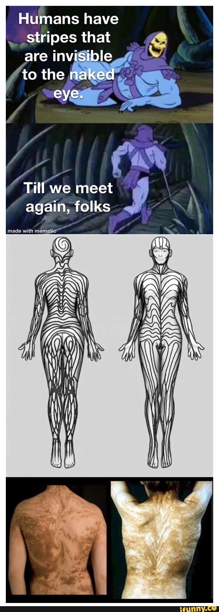 Humans have stripes that are invisible to the naked eye. ff Till we ...
