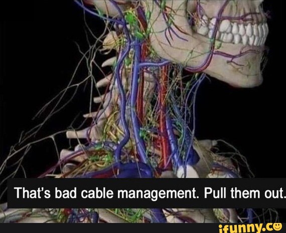 That's bad cable management. Pull them out - iFunny