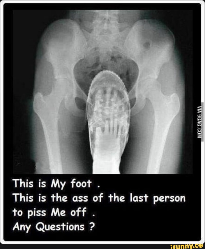 Xray memes. Best Collection of funny Xray pictures on iFunny