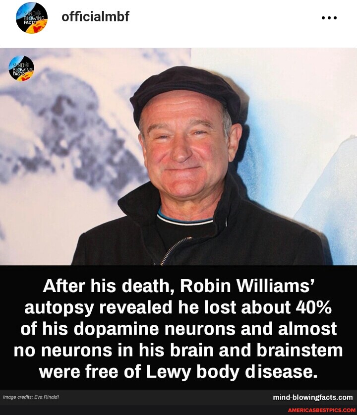 Officialmbf After his death, Robin Williams' autopsy revealed he lost ...