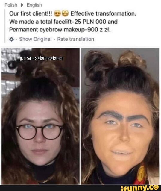 Facelift memes. Best Collection of funny Facelift pictures on iFunny