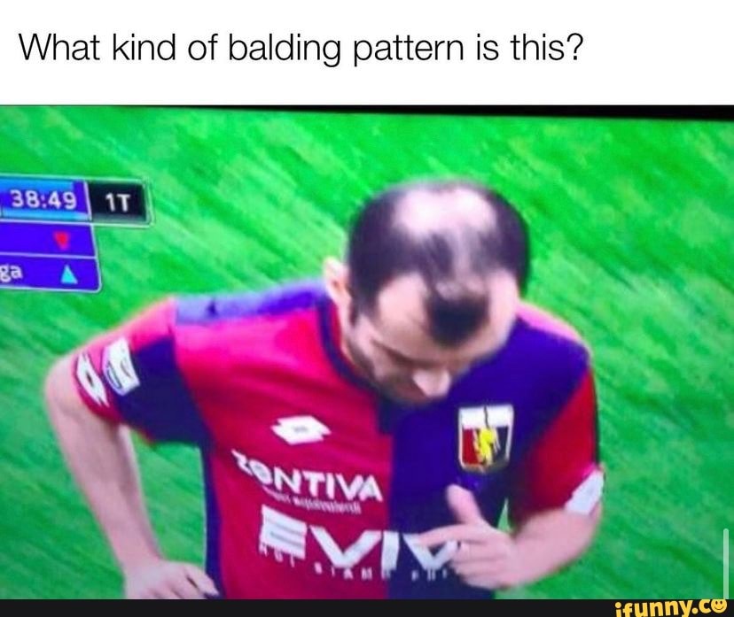 Balding memes. Best Collection of funny Balding pictures on iFunny