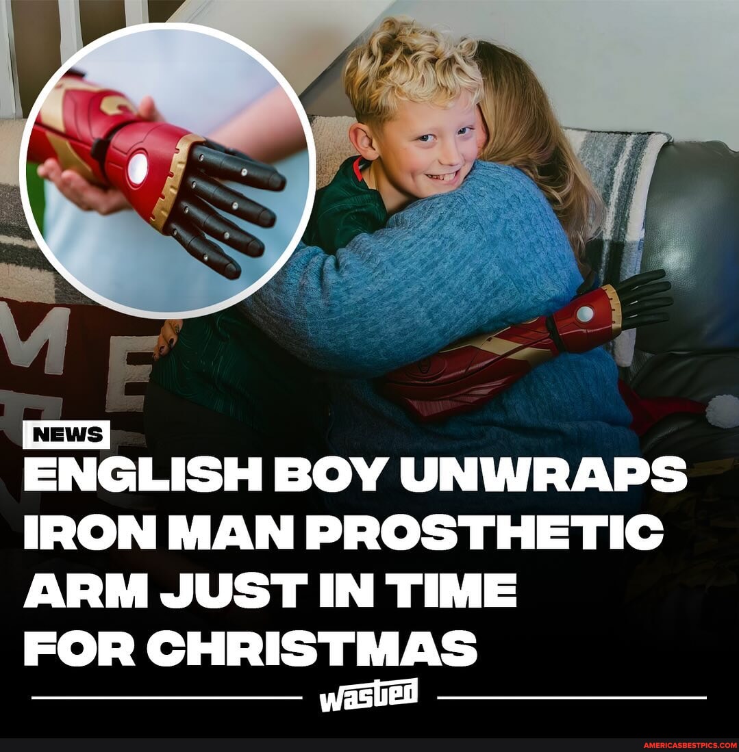 Ten-year-old Harry from Lancashire, UK, received a bionic arm through ...