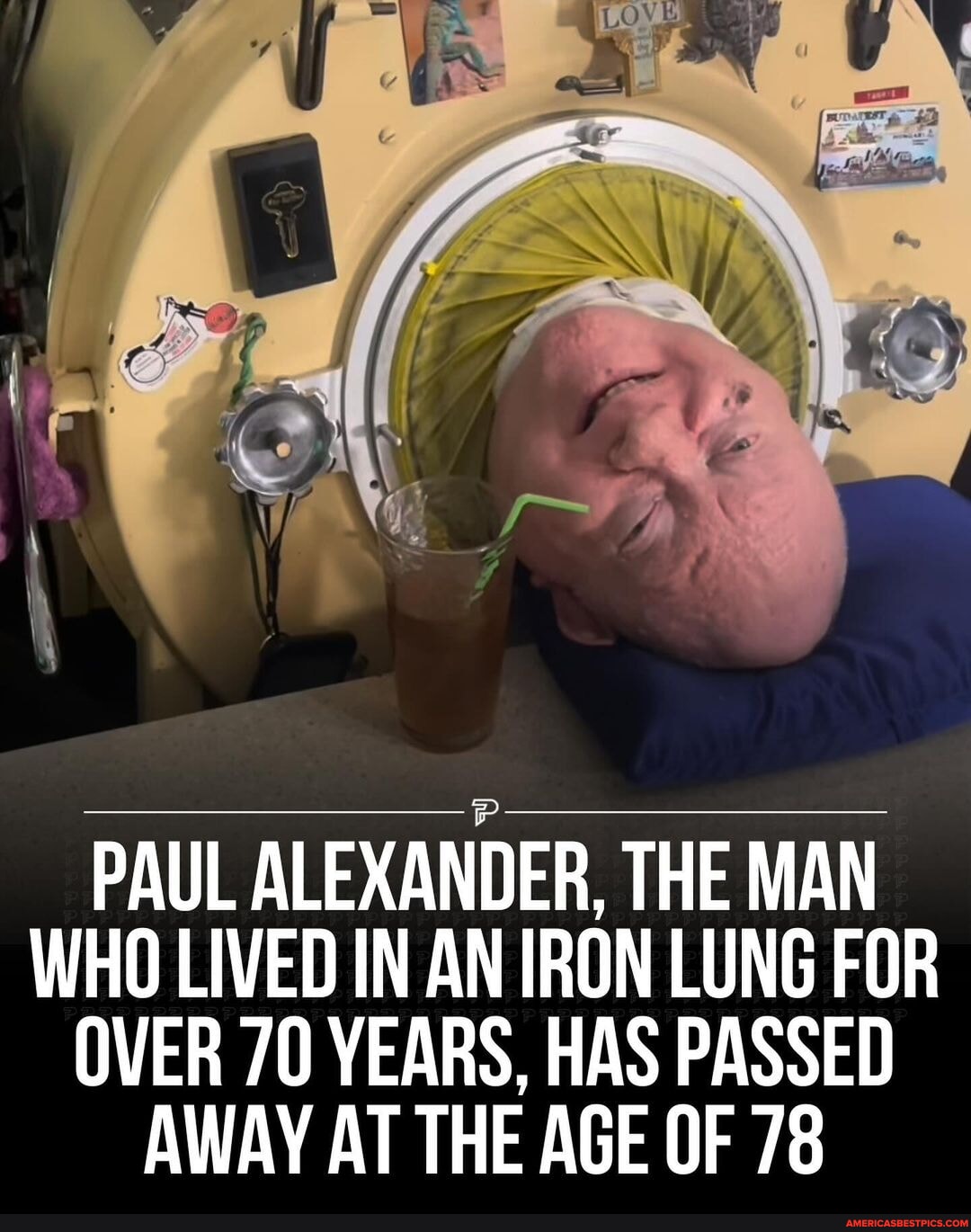 Paul Alexander, who spent more than 70 years living inside an iron lung ...