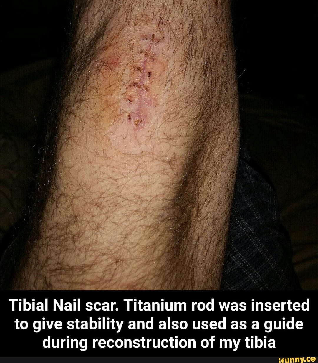 Tibial memes. Best Collection of funny Tibial pictures on iFunny