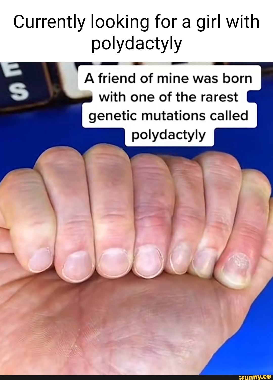 Polydactyly memes. Best Collection of funny Polydactyly pictures on iFunny