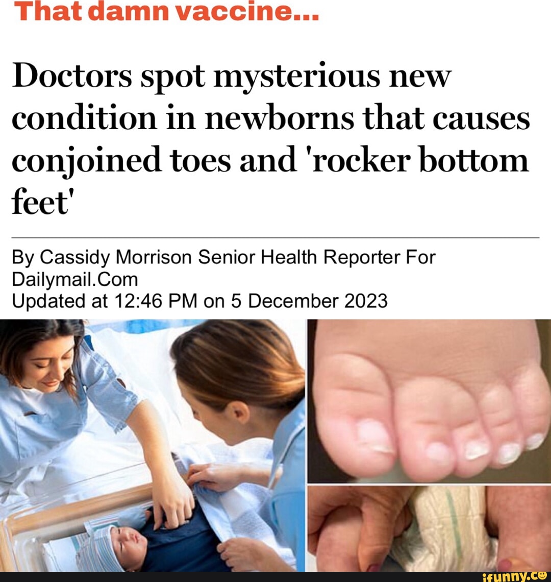 Conjoined memes. Best Collection of funny Conjoined pictures on iFunny