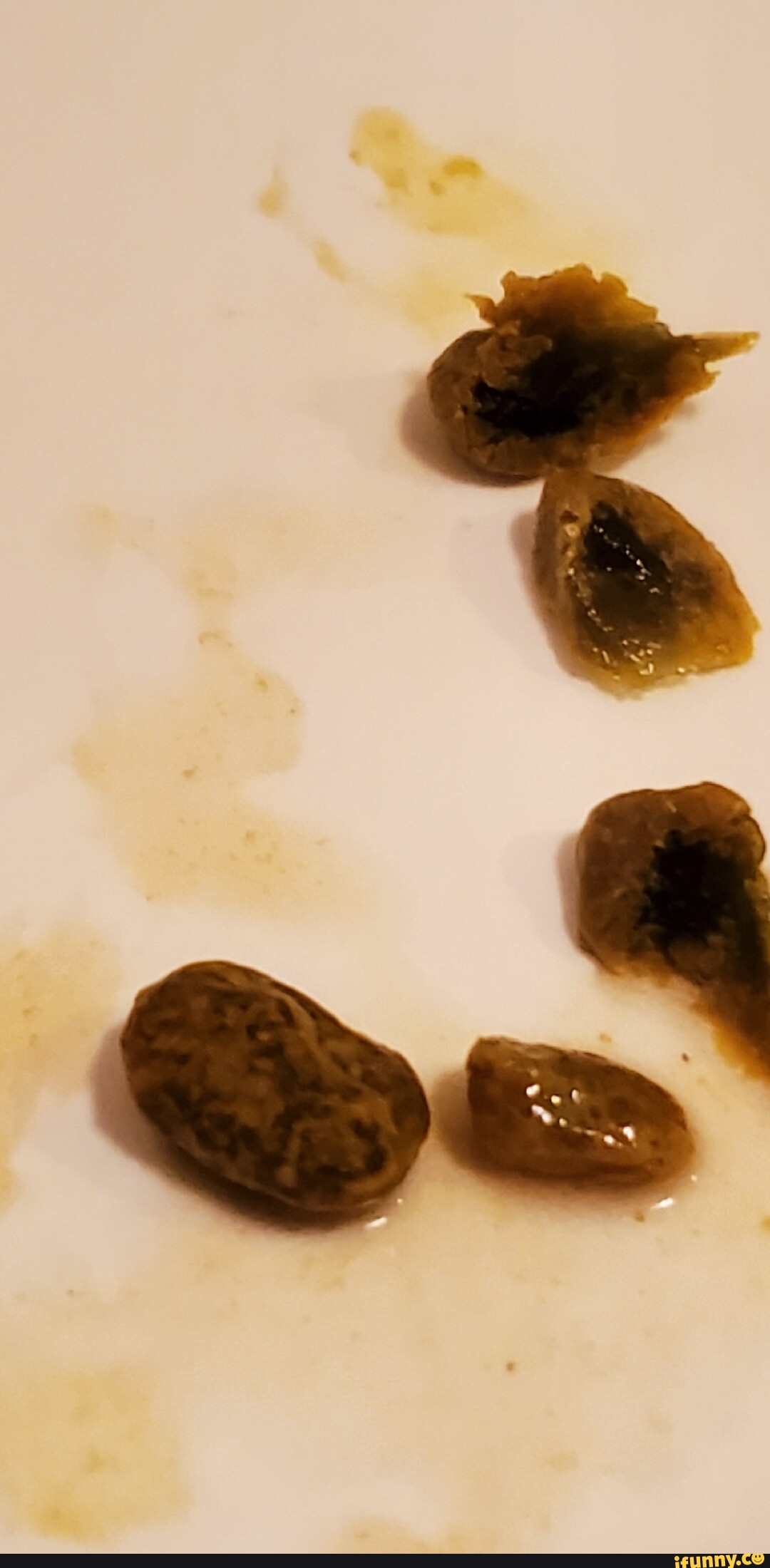 Gallstones memes. Best Collection of funny Gallstones pictures on iFunny