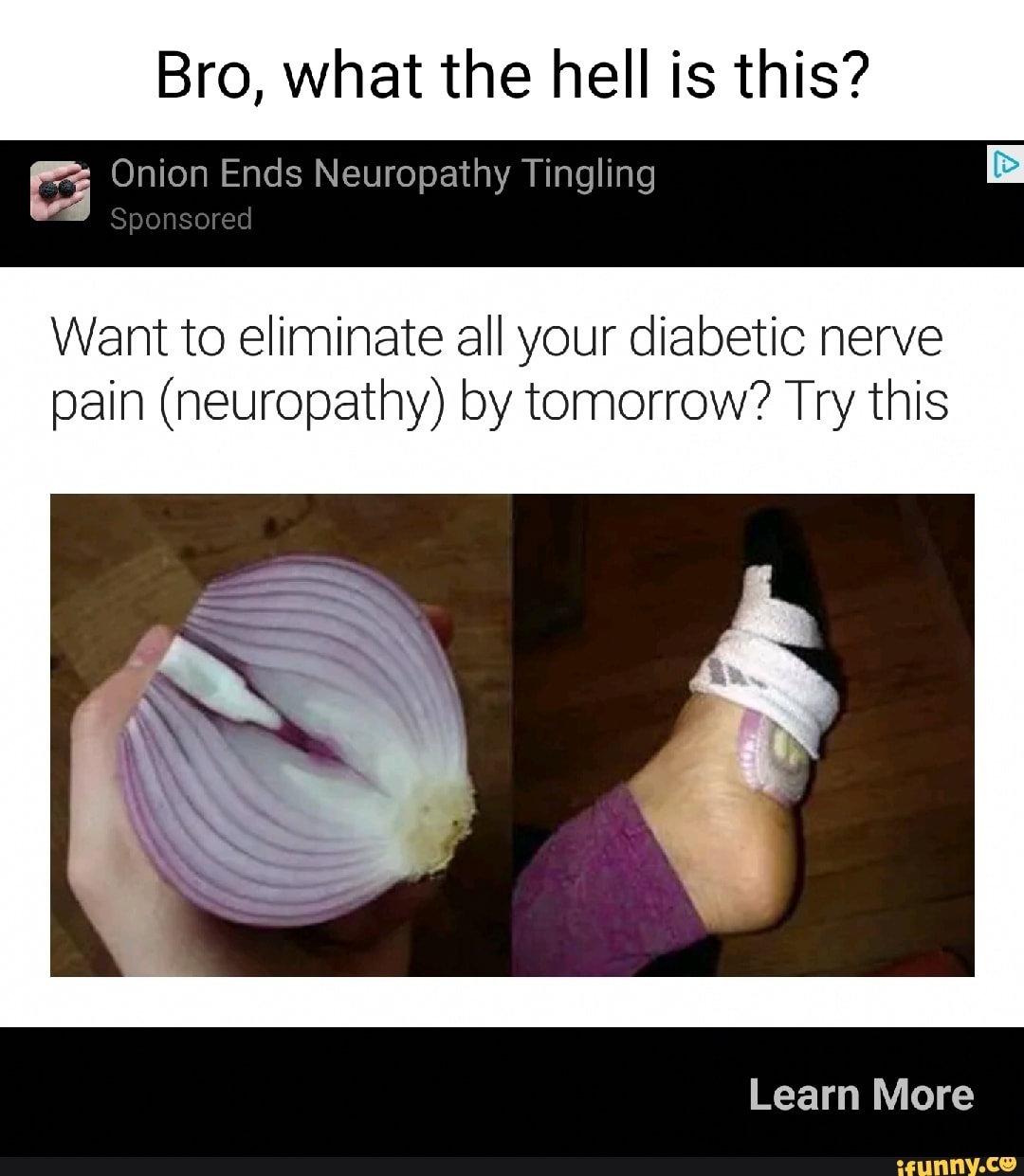 Neuropathy memes. Best Collection of funny Neuropathy pictures on iFunny