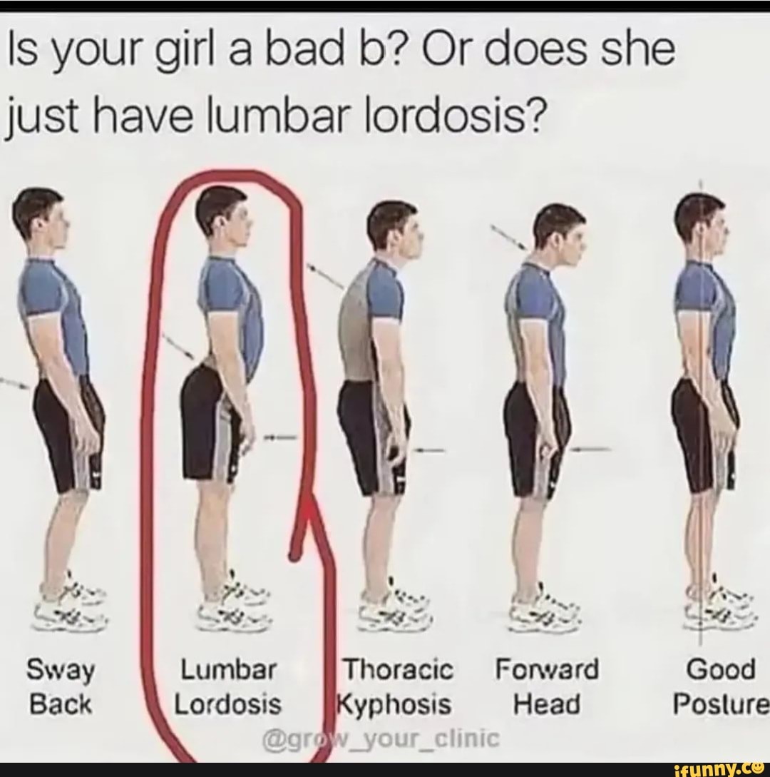 Is your girl a bad lo? Or does she just have lumbar lordosis? wee Sway ...