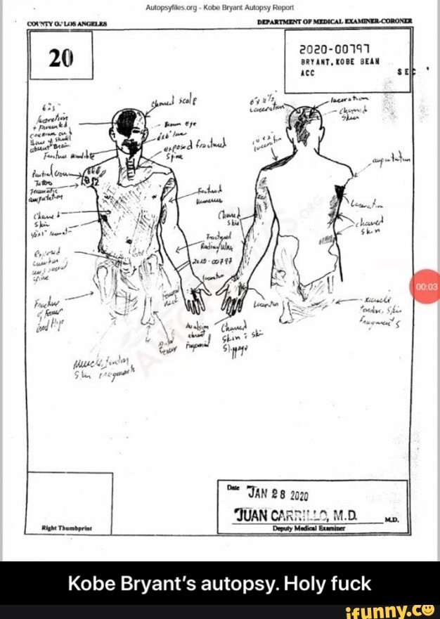 CORONER Kobe Bryant's autopsy. Holy - Kobe Bryant’s autopsy. Holy fuck ...