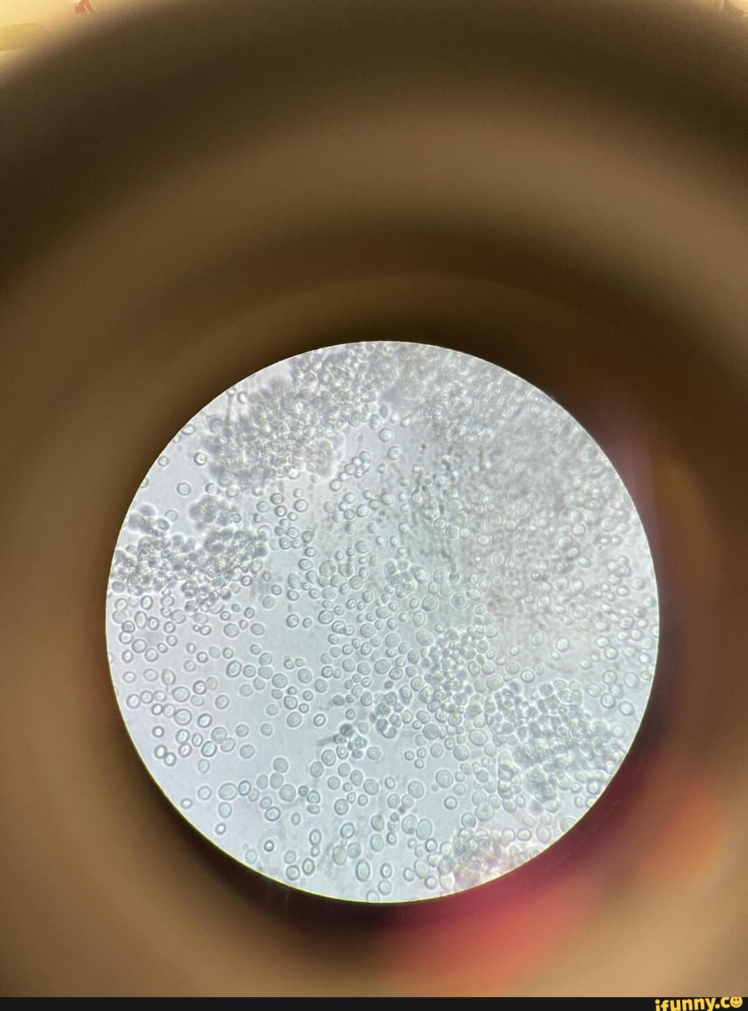Yeast under 1000x microscope/oil immersion. Each “bubble” is one yeast ...