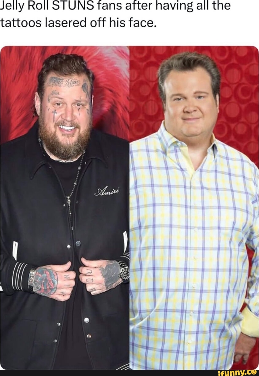Jelly Roll STUNS fans after having ail the tattoos lasered off his face ...