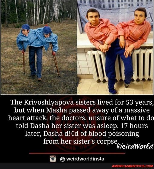 The Krivoshlyapova sisters lived for 53 years, but when Masha passed ...